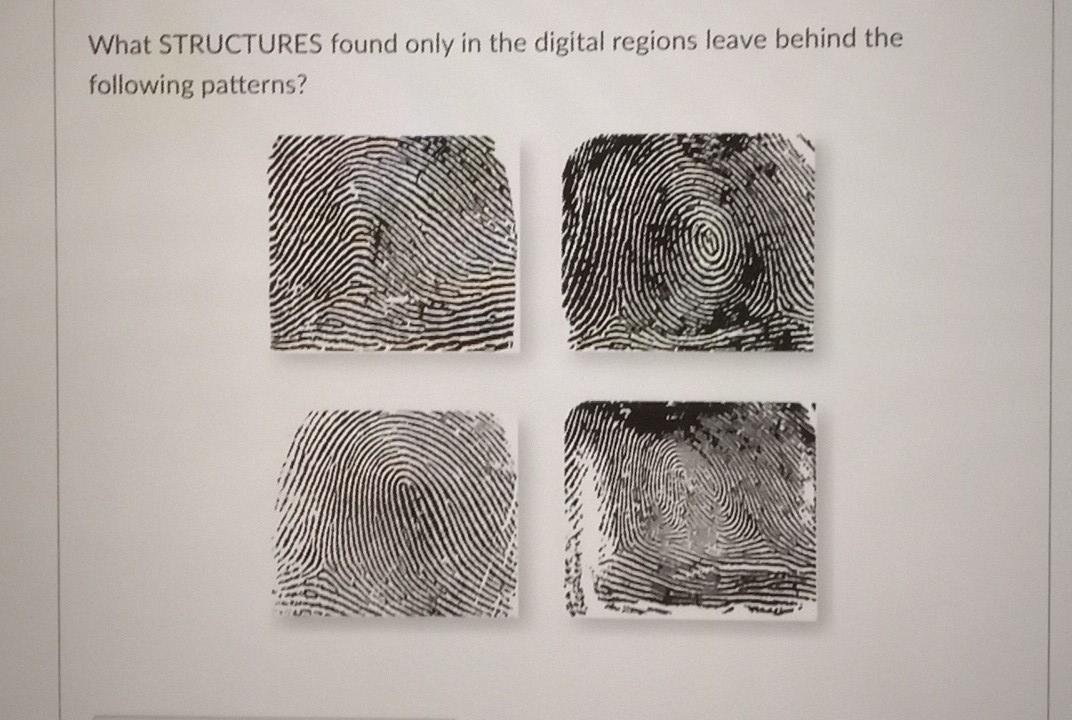 Solved What STRUCTURES found only in the digital regions | Chegg.com