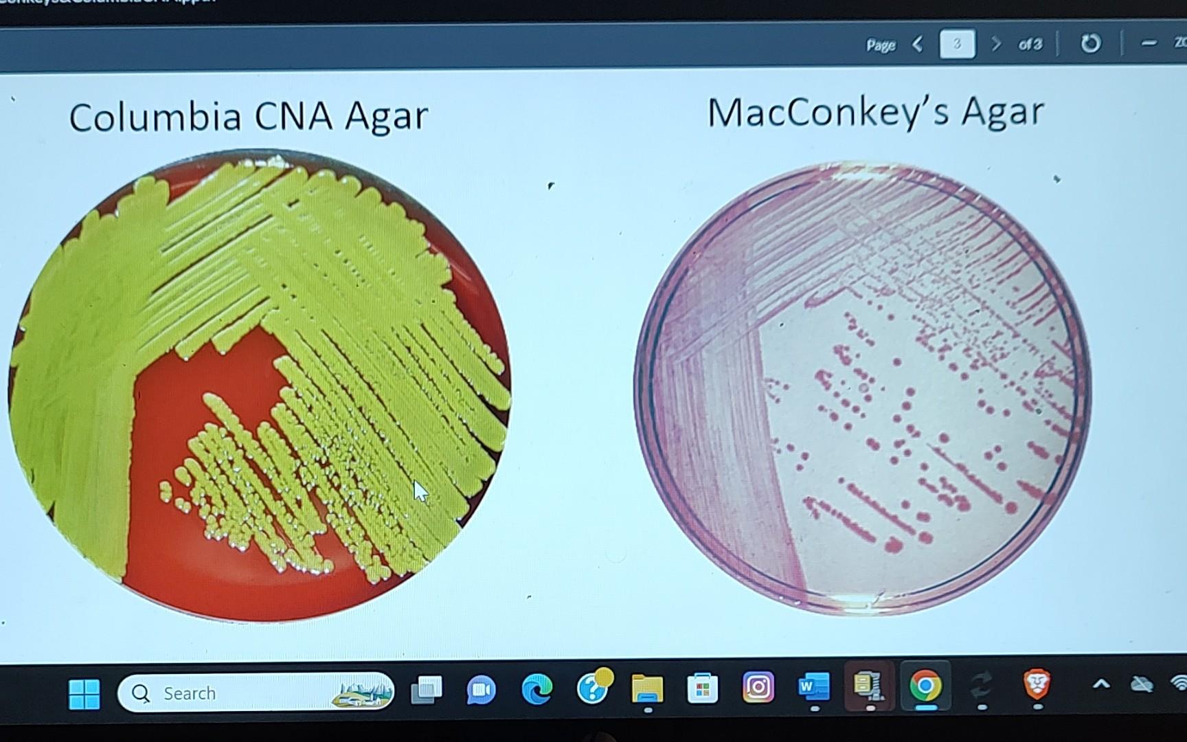 Solved Columbia CNA Agar MacConkey's AgarDirectionsi The | Chegg.com