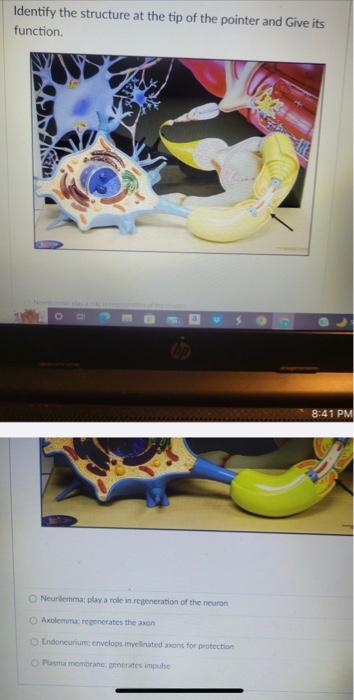 Solved Identify the structure at the tip of the pointer and | Chegg.com