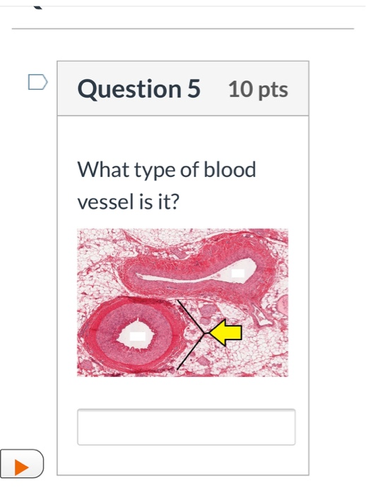 Solved Question 1 10 pts Name this blood vessel (in red) D | Chegg.com Solved Question 1 10 pts Name this blood vessel (in red) D | Chegg.com