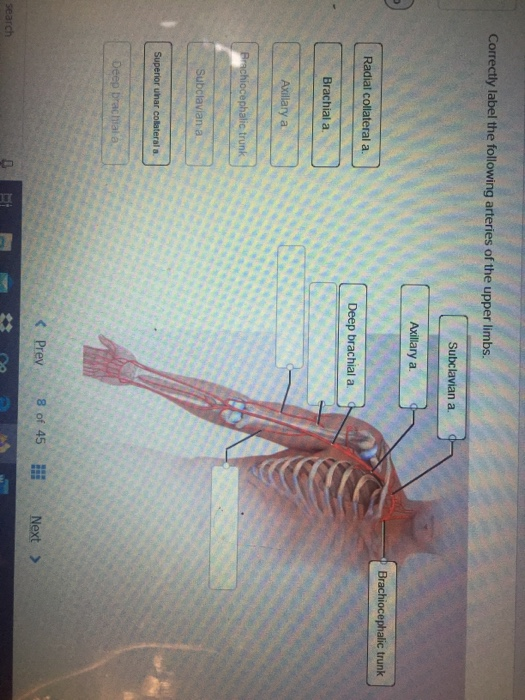 Solved Correctly label the following arteries of the upper | Chegg.com