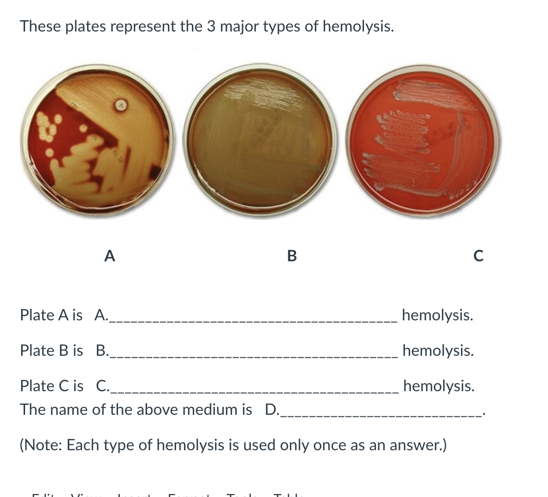 Solved These plates represent the 3 ﻿major types of | Chegg.com