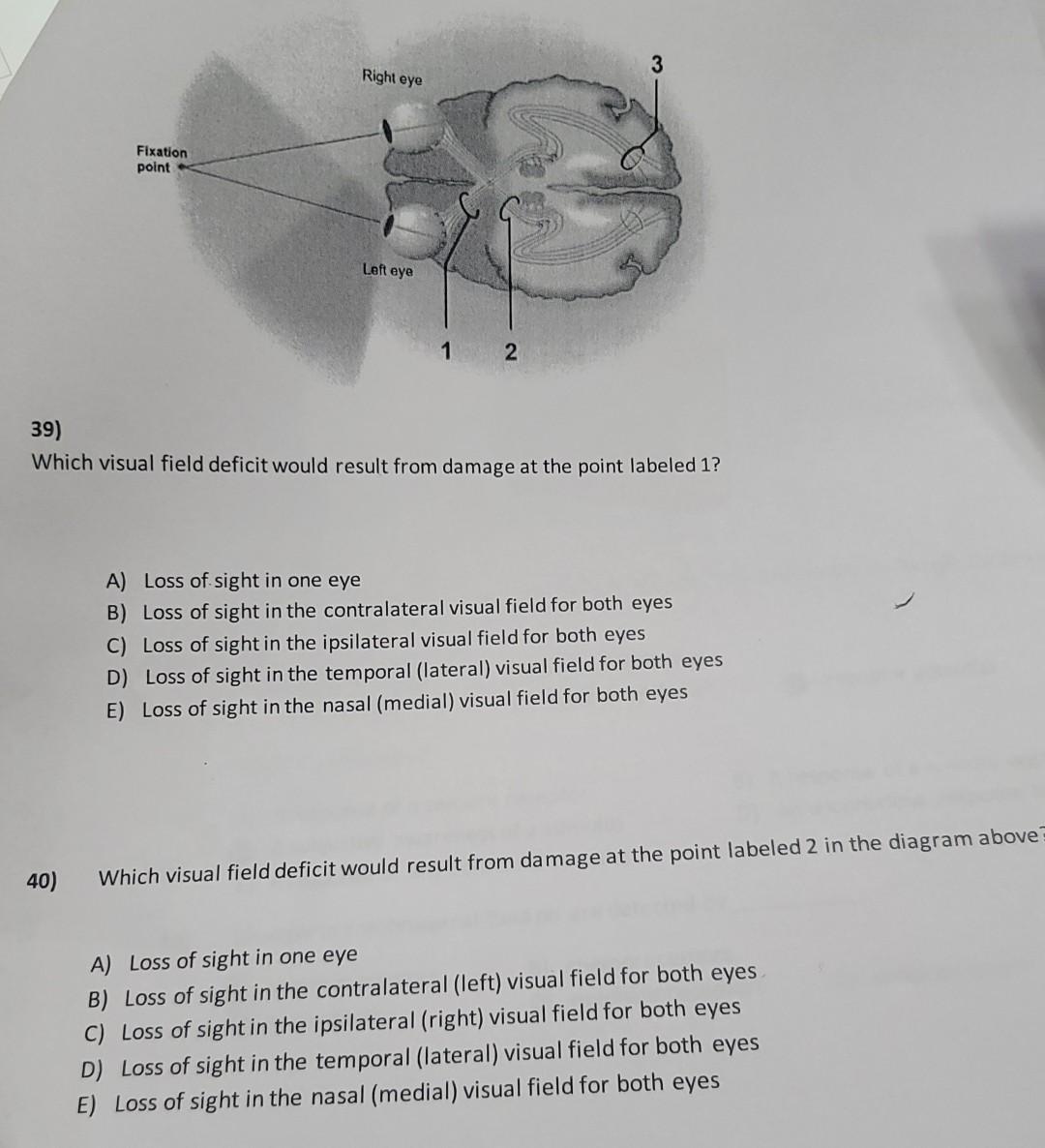 Solved Right eye 3 Fixation point Left eye 2 39) Which | Chegg.com