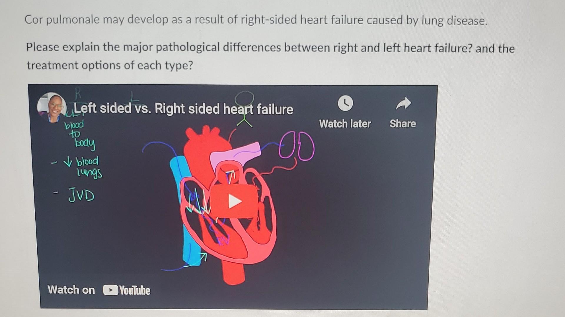 Solved Cor pulmonale may develop as a result of right-sided | Chegg.com