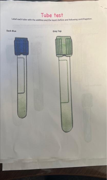 tube test LABEL EACH TUBE WITH HE ADDITIVE AND the | Chegg.com