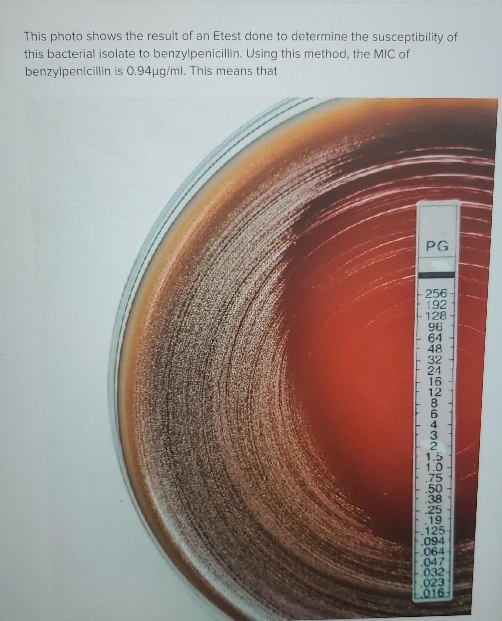 Solved This photo shows the result of an Etest done to | Chegg.com