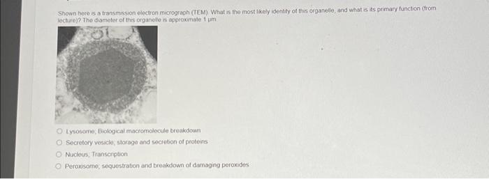 Solved Shown here is a transmission electron micrograph | Chegg.com