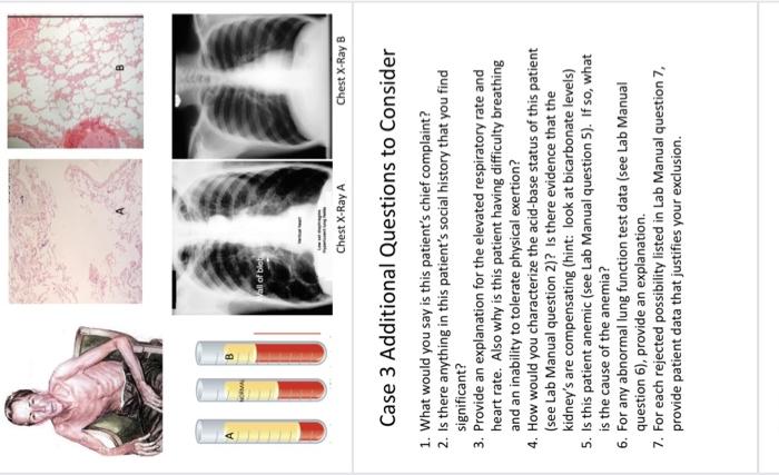 Solved Chest X-Ray A Chest X-Ray B Case 3 Additional | Chegg.com
