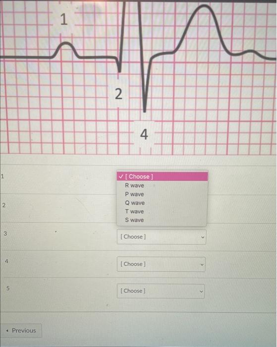 Solved [Choose] Coronary arteries Superior vena cava | Chegg.com