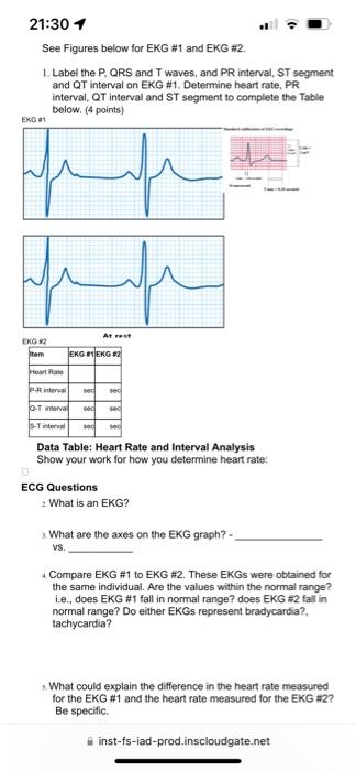 Solved See Figures below for EKG #1 and EKG #2. 1. Label the | Chegg.com