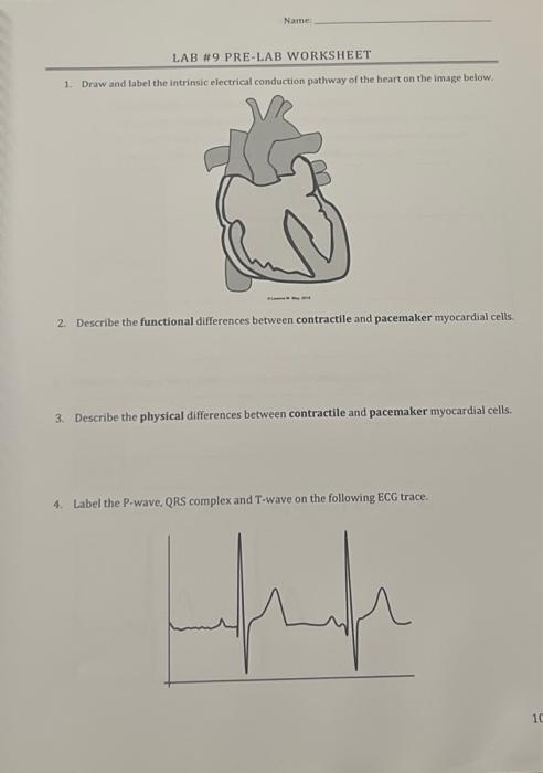 Solved 1. Draw and label the intrinsic electrical conduction | Chegg.com