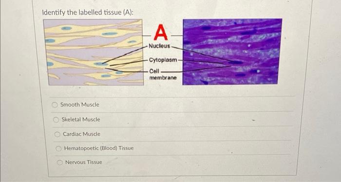 Solved Identify the labelled epithelium (A): Simple cuboidal | Chegg.com