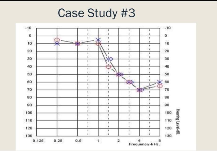 Solved interpret each audiogram. for each case, are | Chegg.com