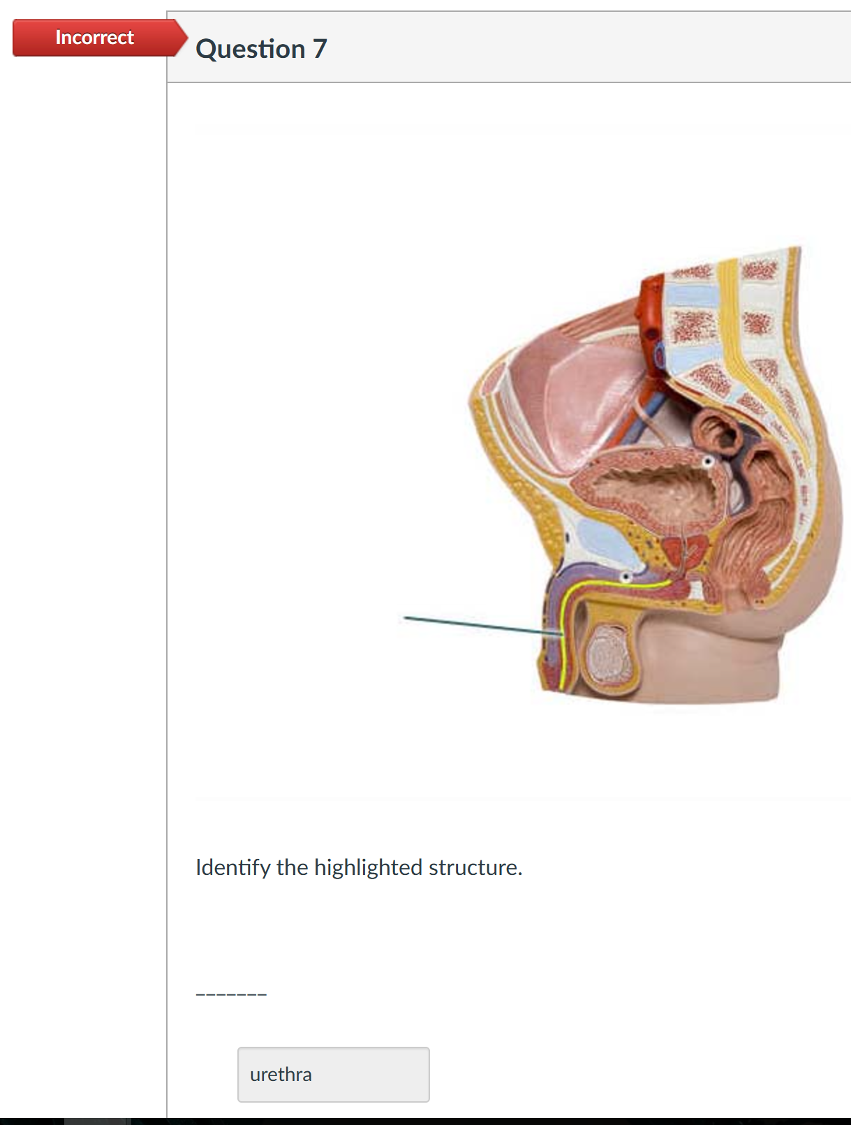 Solved Identify the highlighted structure. Figure 26-2 The | Chegg.com Solved Identify the highlighted structure. Figure 26-2 The | Chegg.com