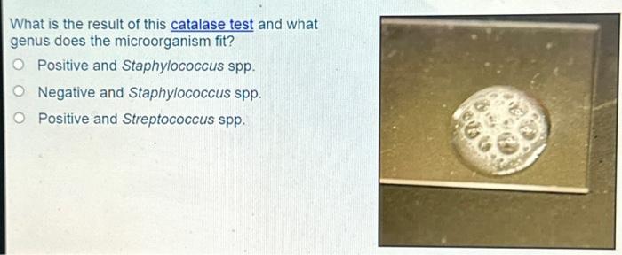 Solved What is the result of this catalase test and what | Chegg.com