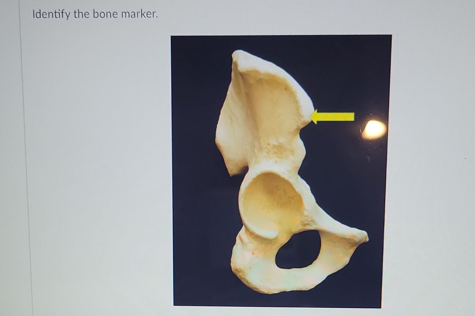 Solved Identify the bone marker indicated by the red | Chegg.com