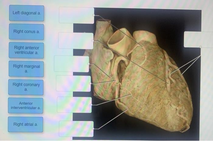 Solved Left diagonal a Right conus a Right anterior | Chegg.com