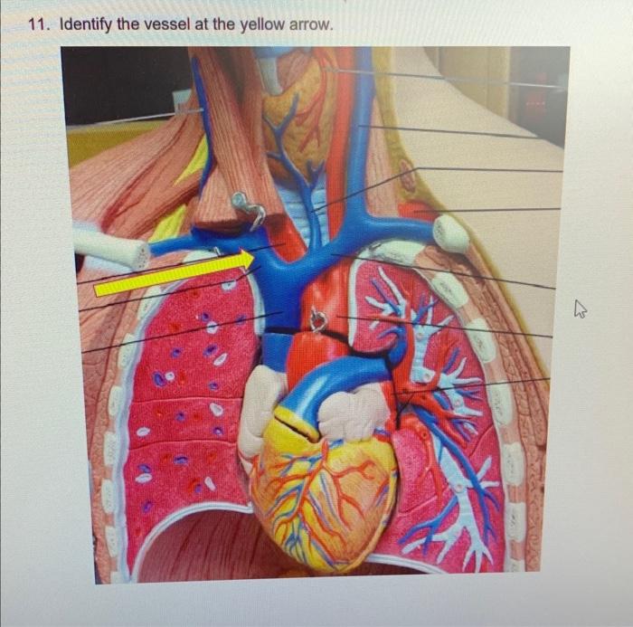 Solved 11. Identify the vessel at the yellow arrow. | Chegg.com
