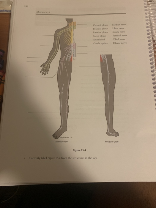 Solved Cervical plexus Brachial plexus Lumbar plexus Sacral | Chegg.com
