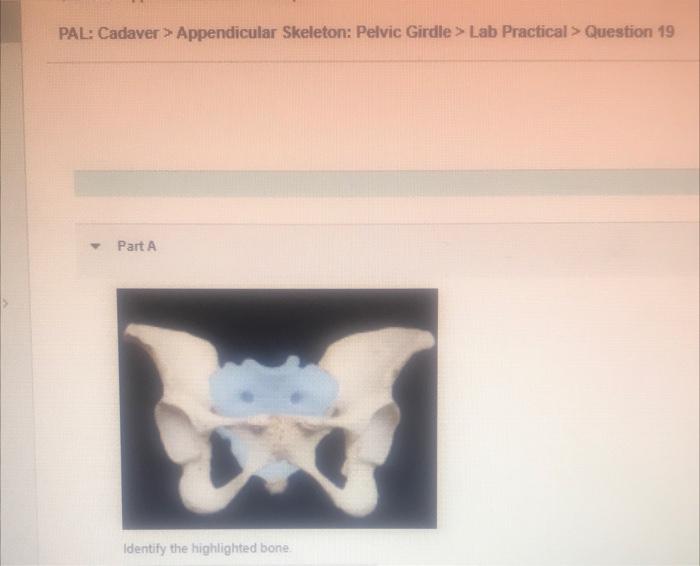 Solved PAL: Cadaver > Appendicular Skeleton: Pelvic Girdle > | Chegg.com