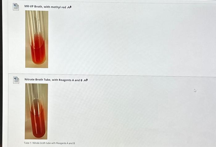 Solved Nutrient Agar, Culture Growth Gram stain Crystal | Chegg.com