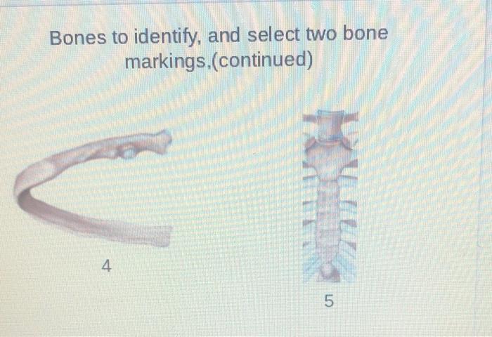 Solved In the next slides, name and classify the bones | Chegg.com