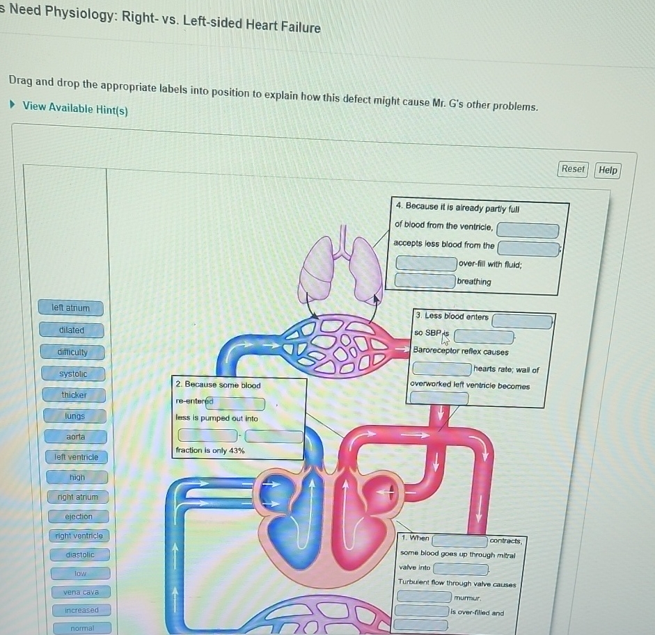 Solved send to an experts Need Physiology: Right- ﻿vs. | Chegg.com