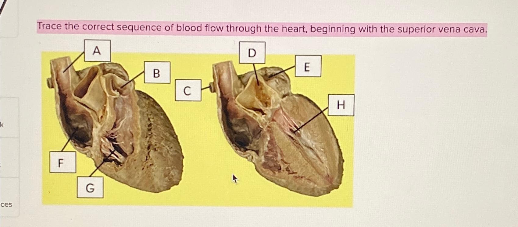 Solved Trace the correct sequence of blood flow through the | Chegg.com