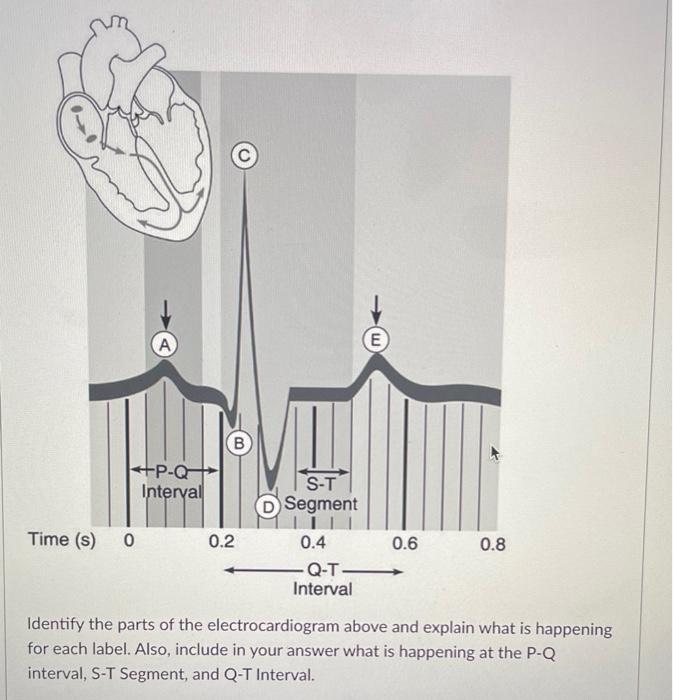 Solved Identify the parts of the electrocardiogram above and | Chegg.com