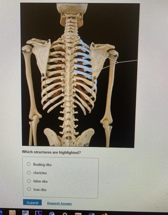 Solved V Part A > Which structures are highlighted? O | Chegg.com