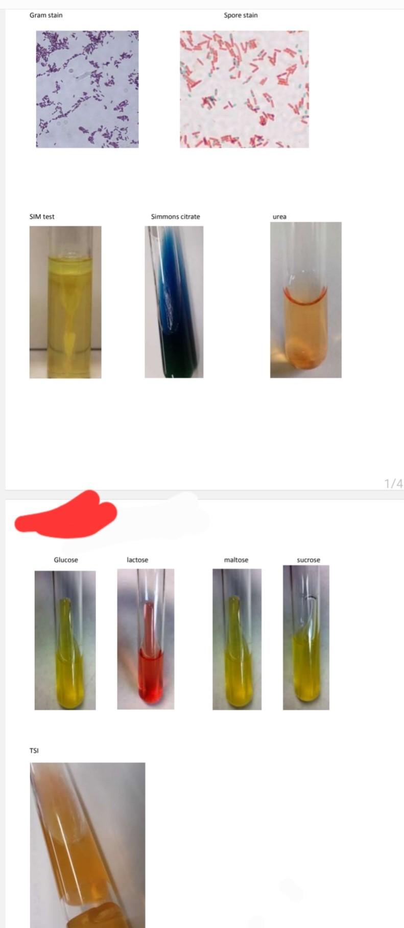 Solved Gram stain Spore stain श SIM test Simmons citrate | Chegg.com