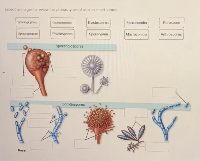 Solved Label the images to review the various types of | Chegg.com