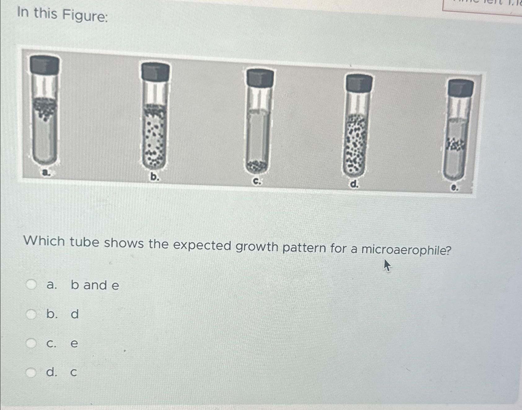 Solved In this Figure:Which tube shows the expected growth | Chegg.com