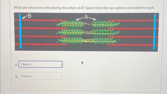 Solved What are structures indicated by the letters A-B? | Chegg.com
