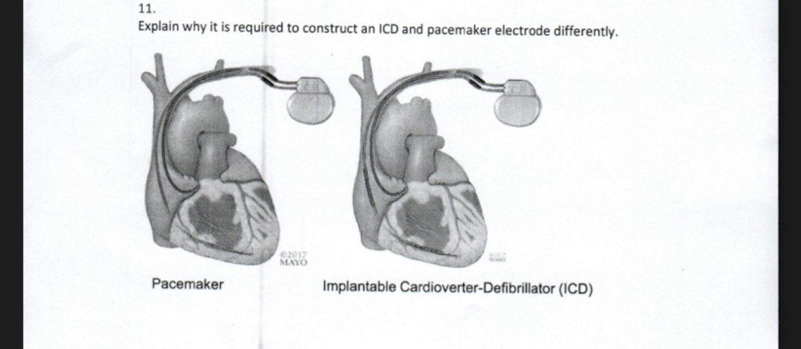 Solved Explain why it is required to construct an ICD and | Chegg.com