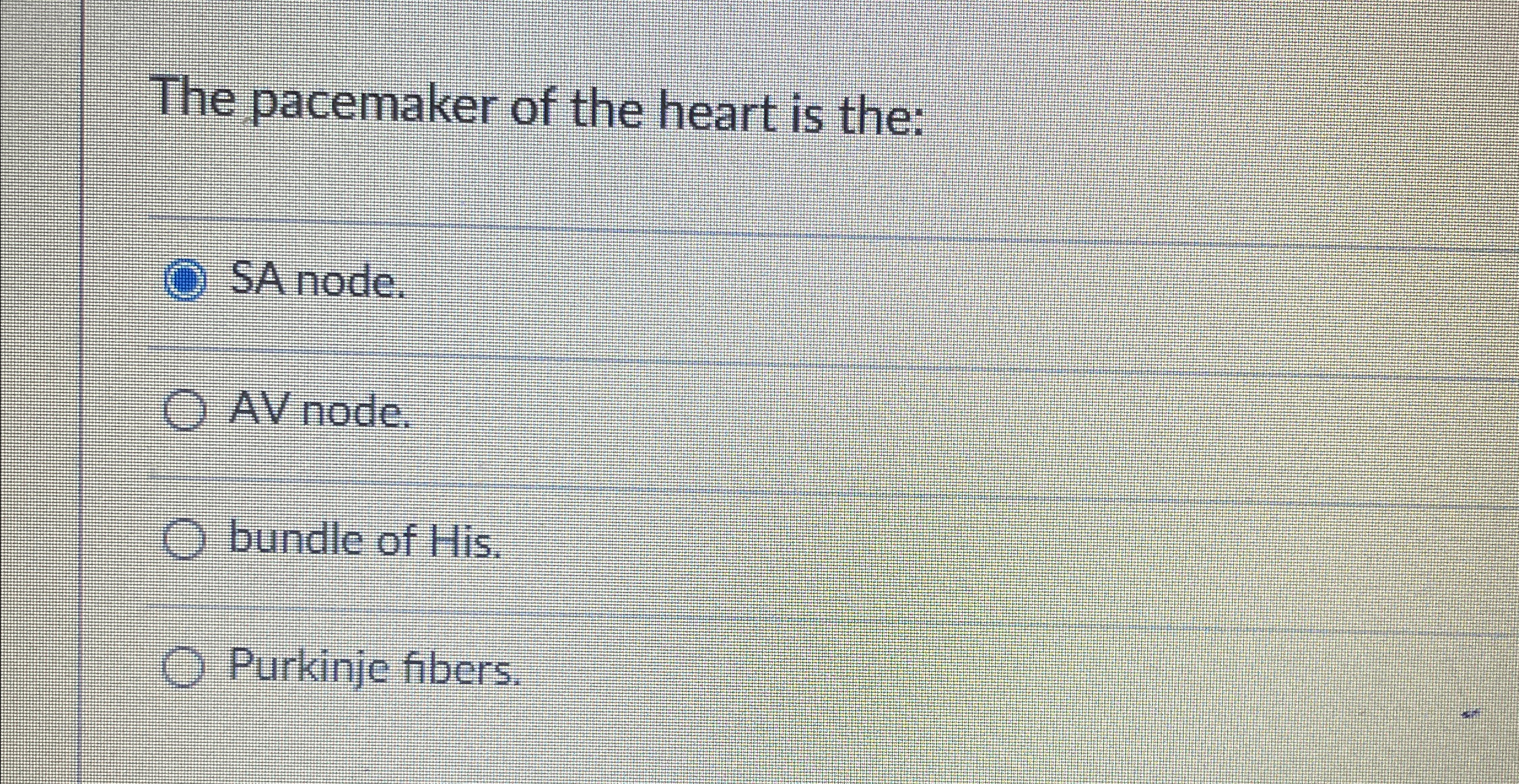 Solved The pacemaker of the heart is the:SA node.AV | Chegg.com