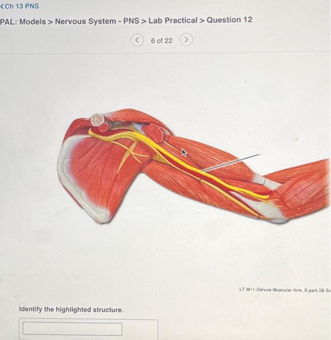 Solved Nervous System - PNS > Lab Practical > Question 12 6 | Chegg.com