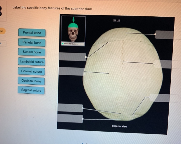 Solved Label the specific bony features of the superior | Chegg.com
