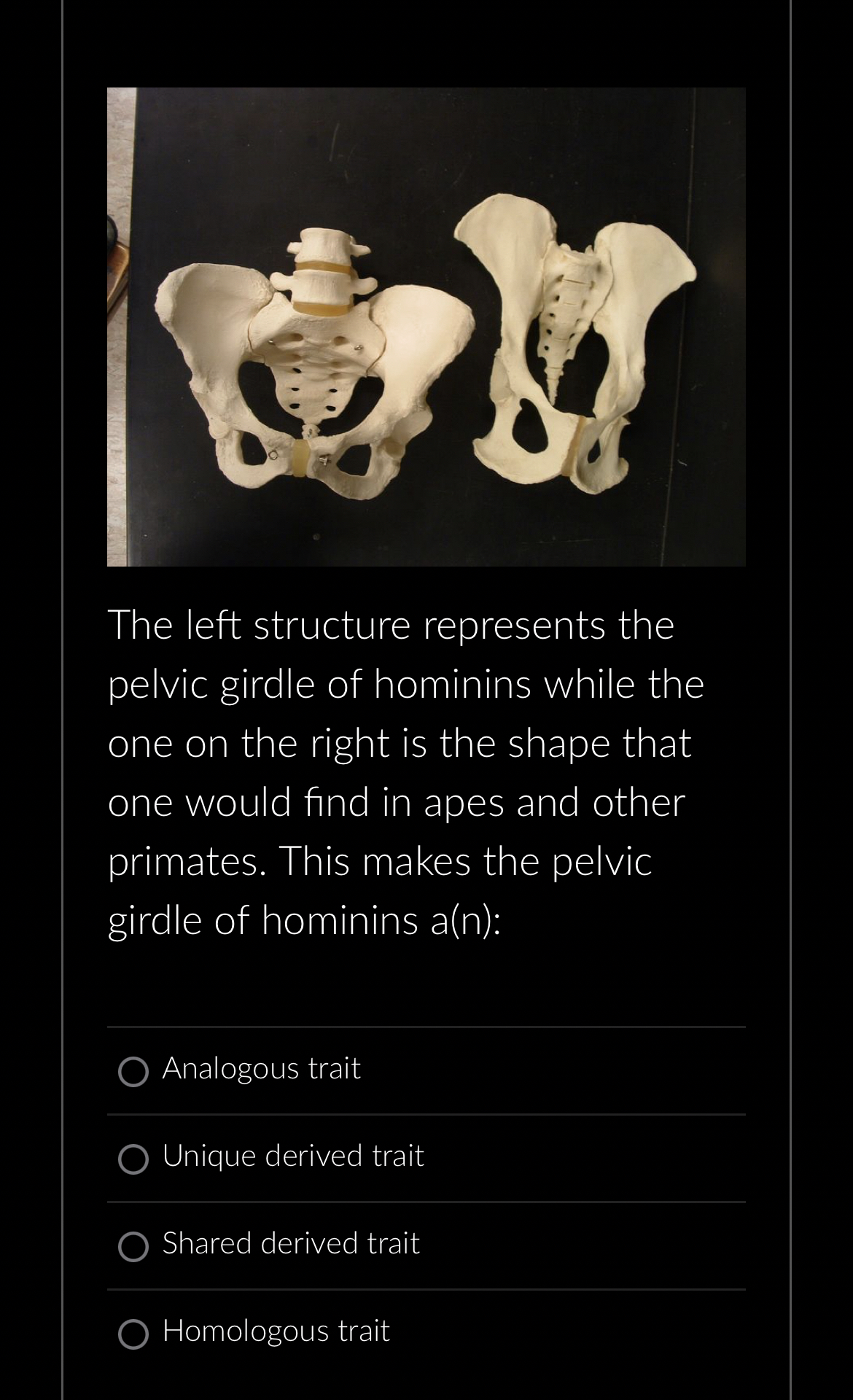 Solved The left structure represents the pelvic girdle of | Chegg.com