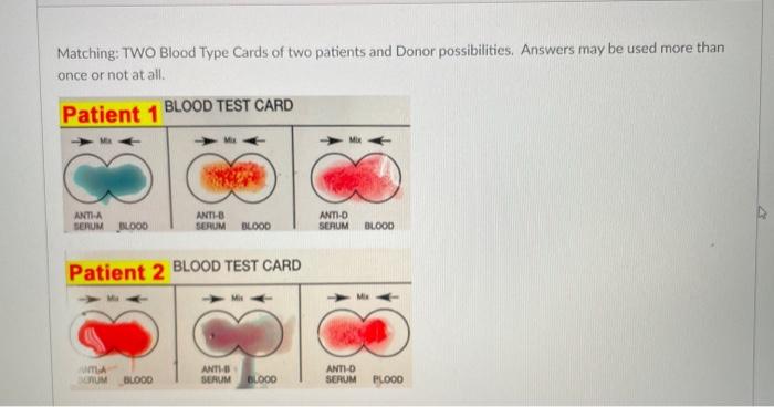 Solved matching two blood type cards of two patients and | Chegg.com