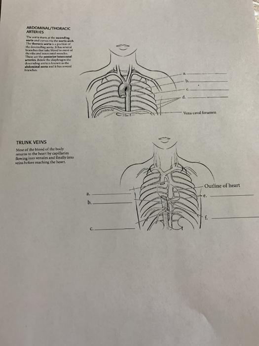 Solved lable and color the vesslrs, create a line diagram to | Chegg.com