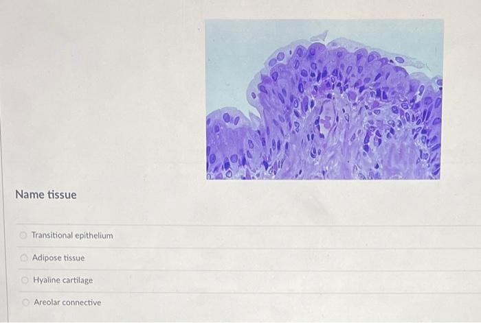 Solved Name tissue Transitional epithelium Adipose tissue | Chegg.com