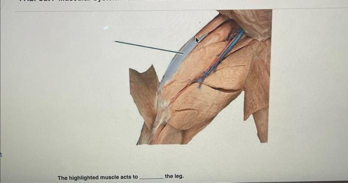 The highlighted muscle acts to the leg. | Chegg.com
