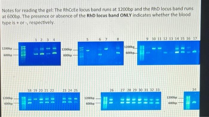 Solved Analyze the PCR product bands present in the DNA gels | Chegg.com