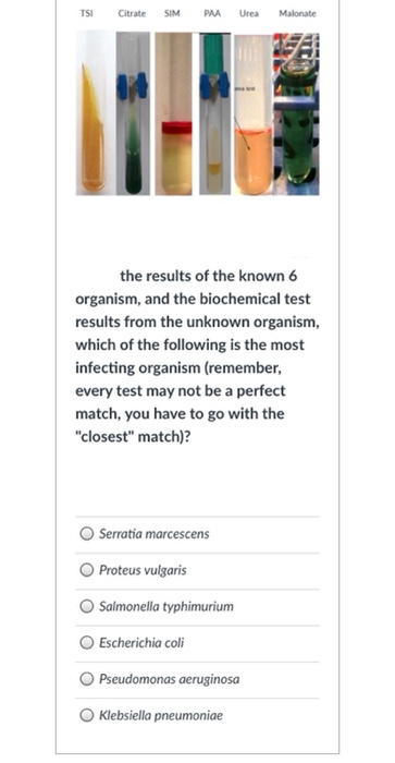 Solved This SIM Deep tube shows E. coli is positive for | Chegg.com