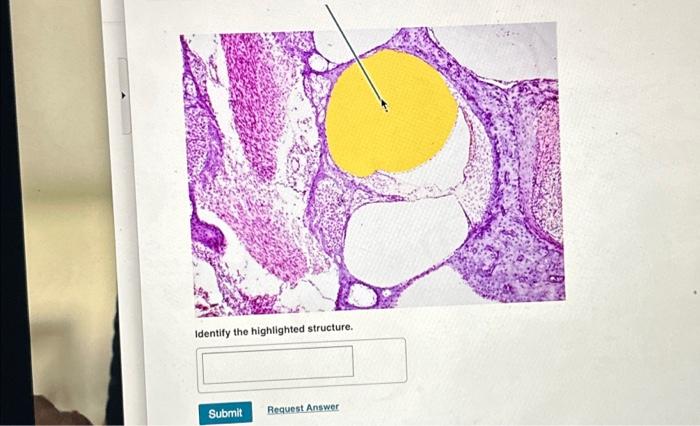 Solved Identify the highlighted structure. Submit Request | Chegg.com