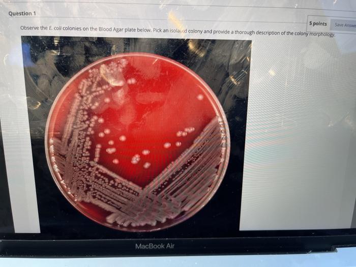 E Coli On Blood Agar