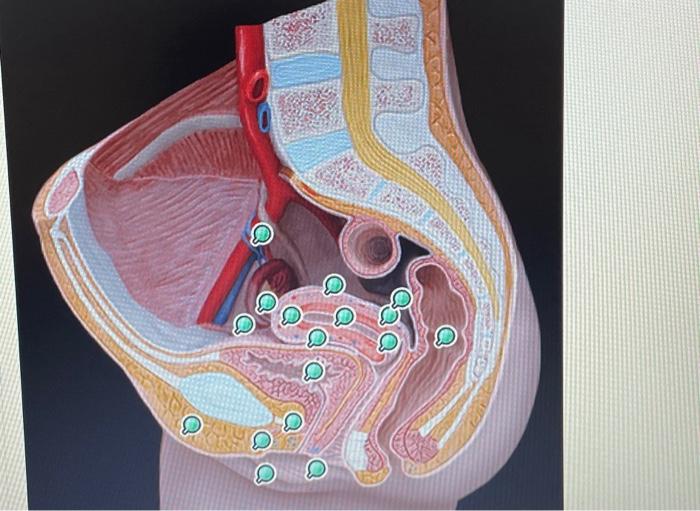 Solved label | Chegg.com