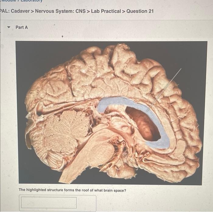 Solved PAL: Cadaver > Nervous System: CNS > Lab Practical > | Chegg.com