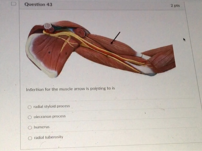 Solved The origin for the muscle arrow is pointing to is | Chegg.com